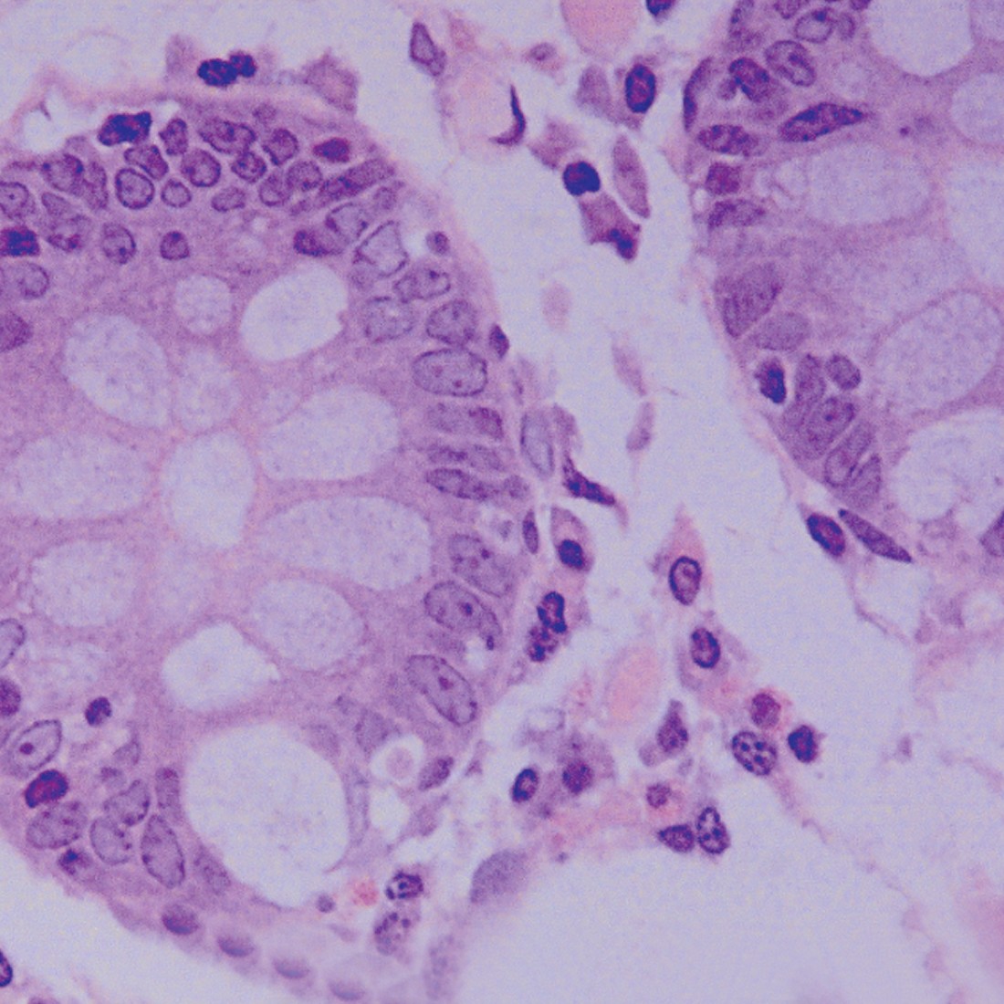 Plastic Embedding Kit at James Sterling blog